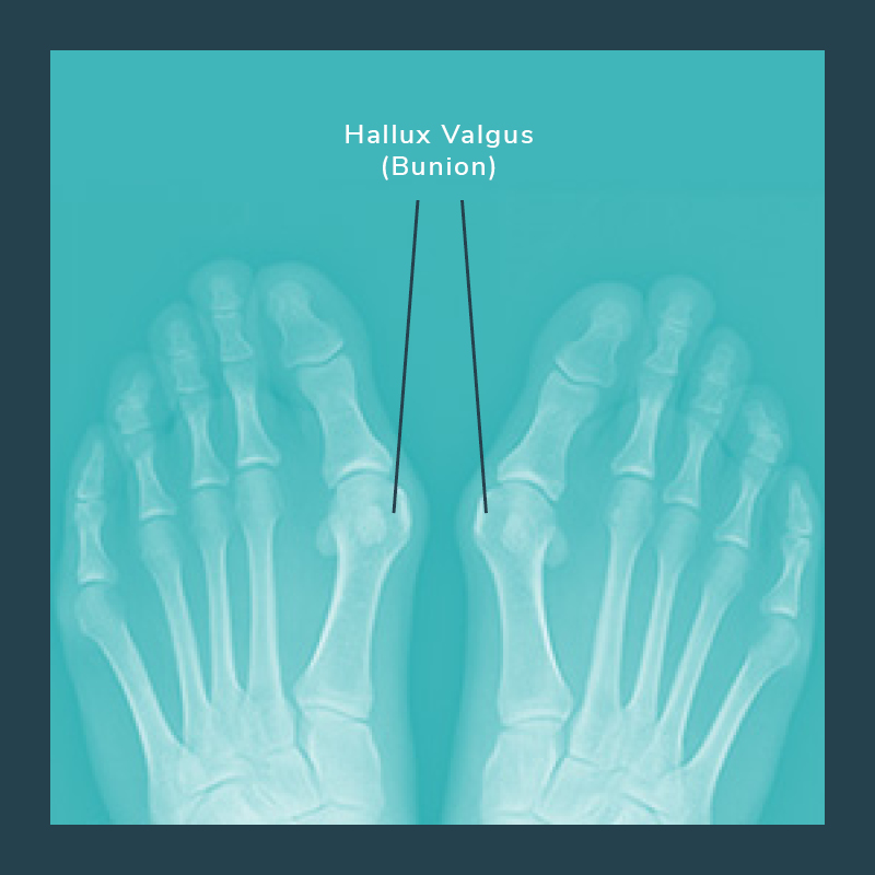 Dr. Cobus Wessels Procedures